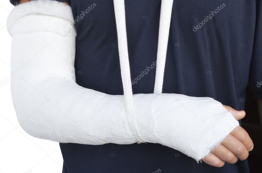 Braccio e Polso con Gesso — Stock Photo © R.Mendolo #7324571