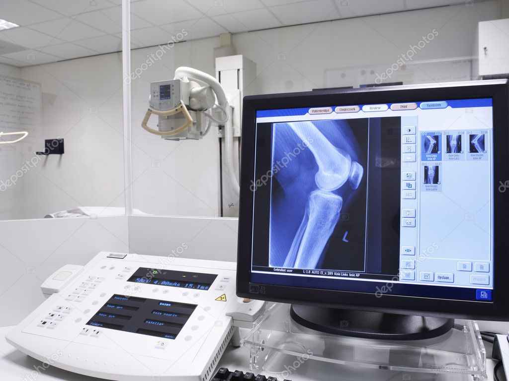 X-ray picture on monitor — Stock Photo © grieze #7468429